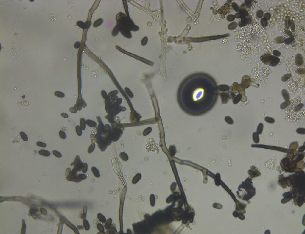 Fungi Testing for Indoor Environment - My Mold Detective